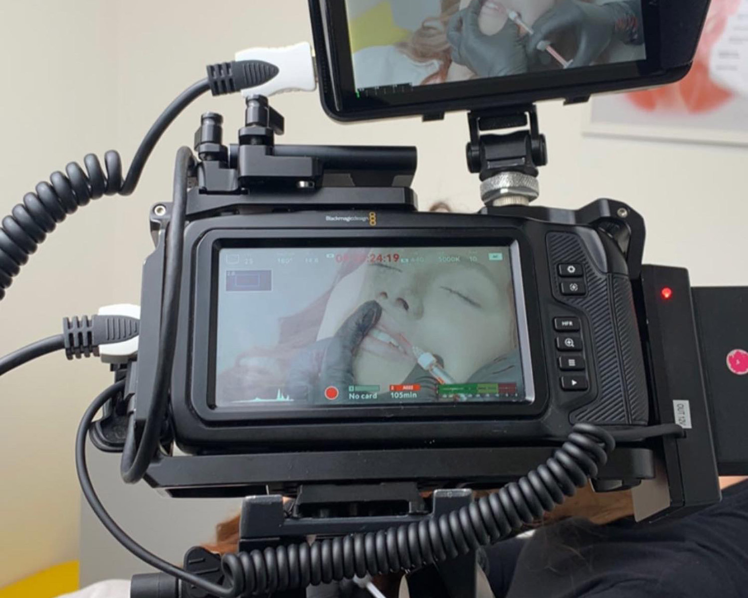 Jaw masterclass - DermaArt Norwich